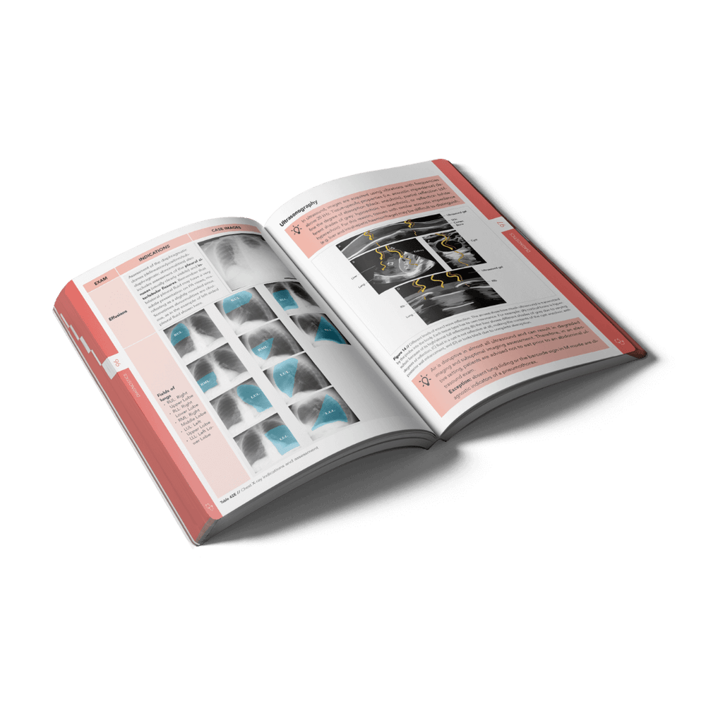 Pocket-sized Acute Medicine book – Compendium Medicine