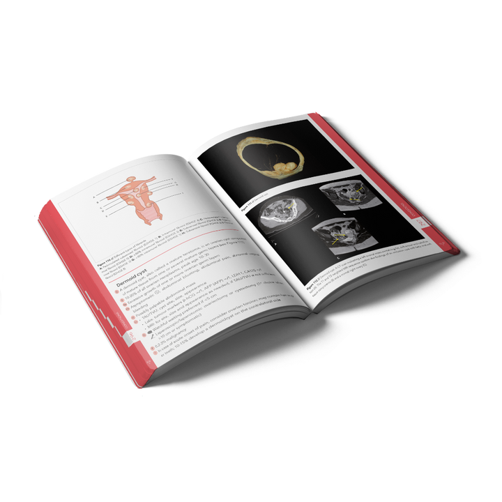 25% OFF | Pocket Obstetrics and Gynaecology (2024) – Compendium Medicine