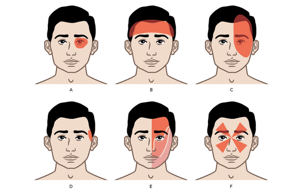 Pocket Neurology – Compendium Medicine